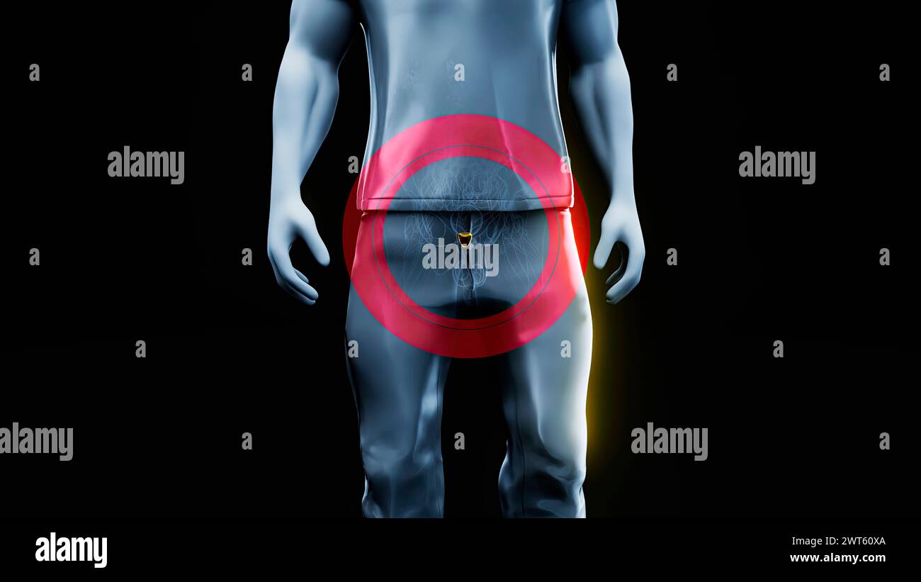 Normal prostate hi-res stock photography and images - Alamy