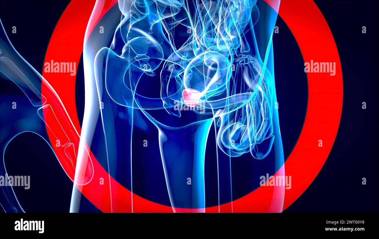 Normal prostate hi-res stock photography and images - Alamy