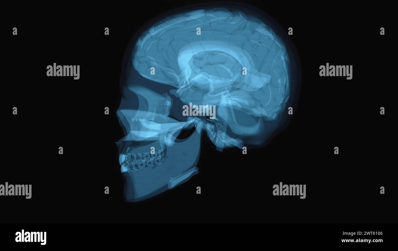 Brain scan, conceptual illustration Stock Photo - Alamy