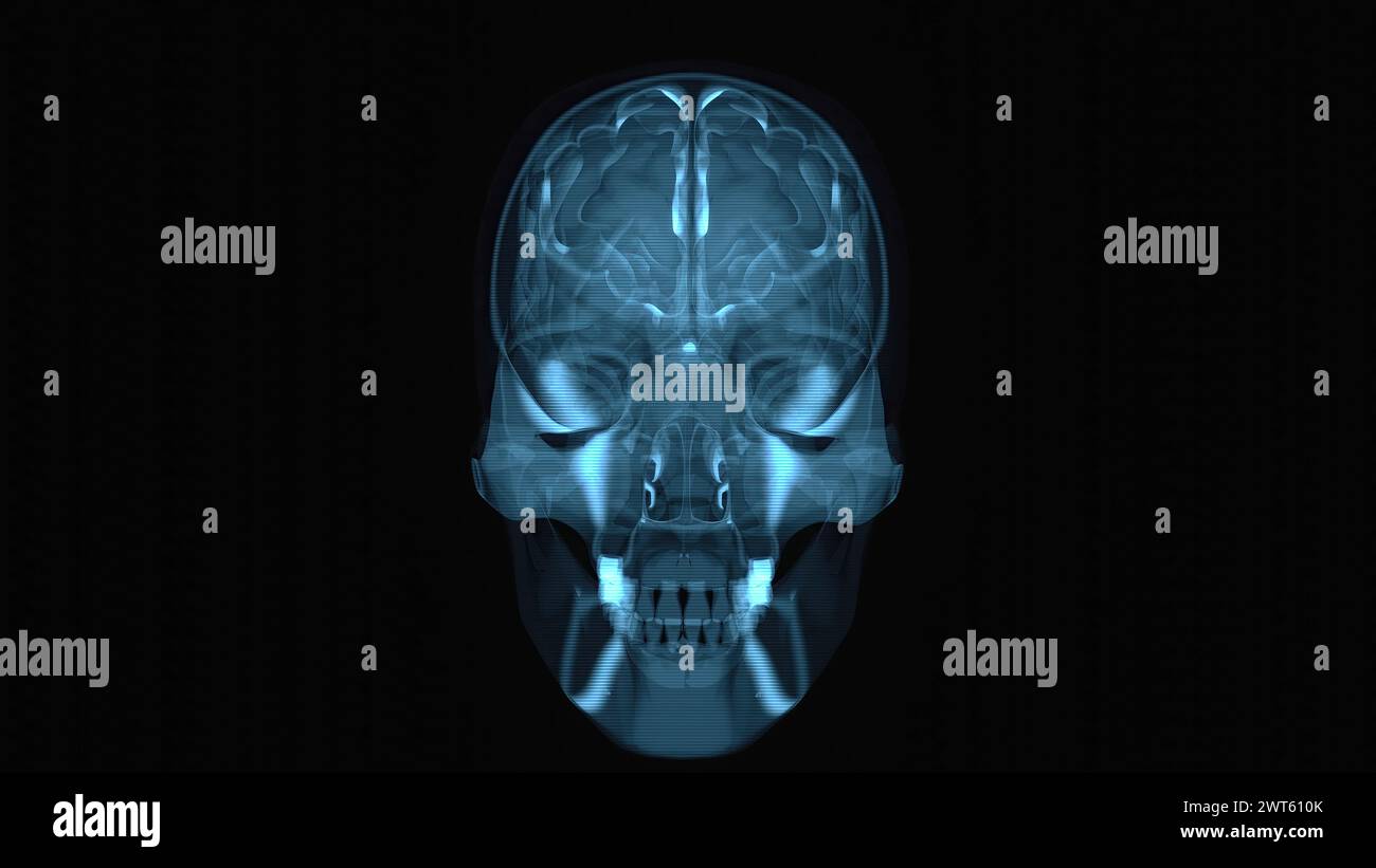 Brain scan, conceptual illustration Stock Photo - Alamy