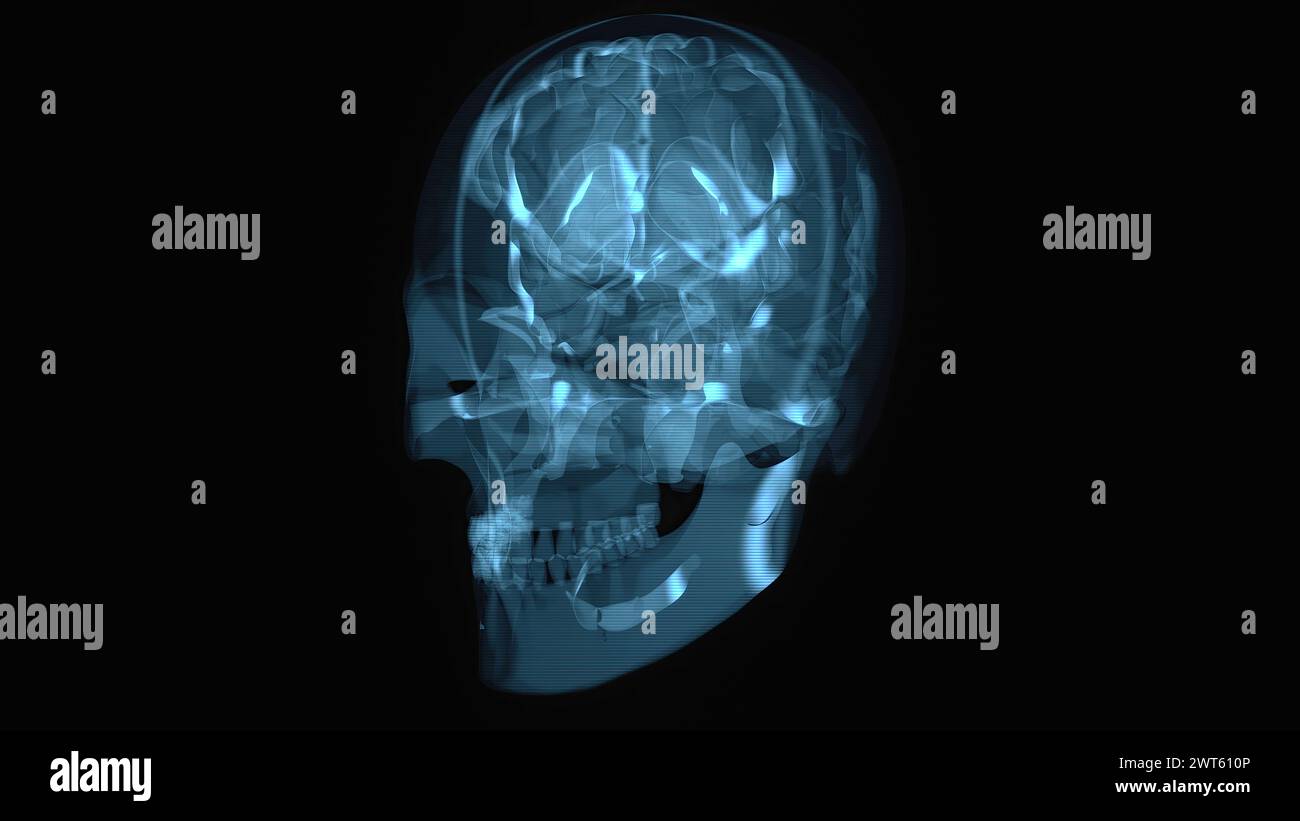 Brain scan, conceptual illustration Stock Photo - Alamy