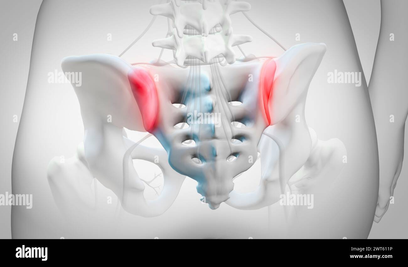 Inflammation of sacroiliac joints, illustration Stock Photo - Alamy