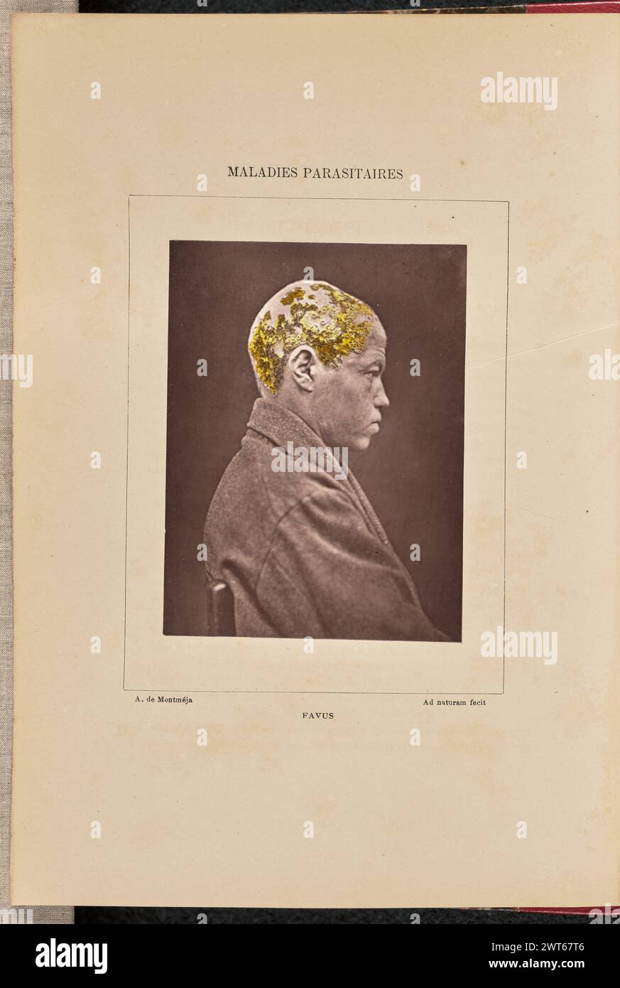 Ringworm head hi-res stock photography and images - Alamy