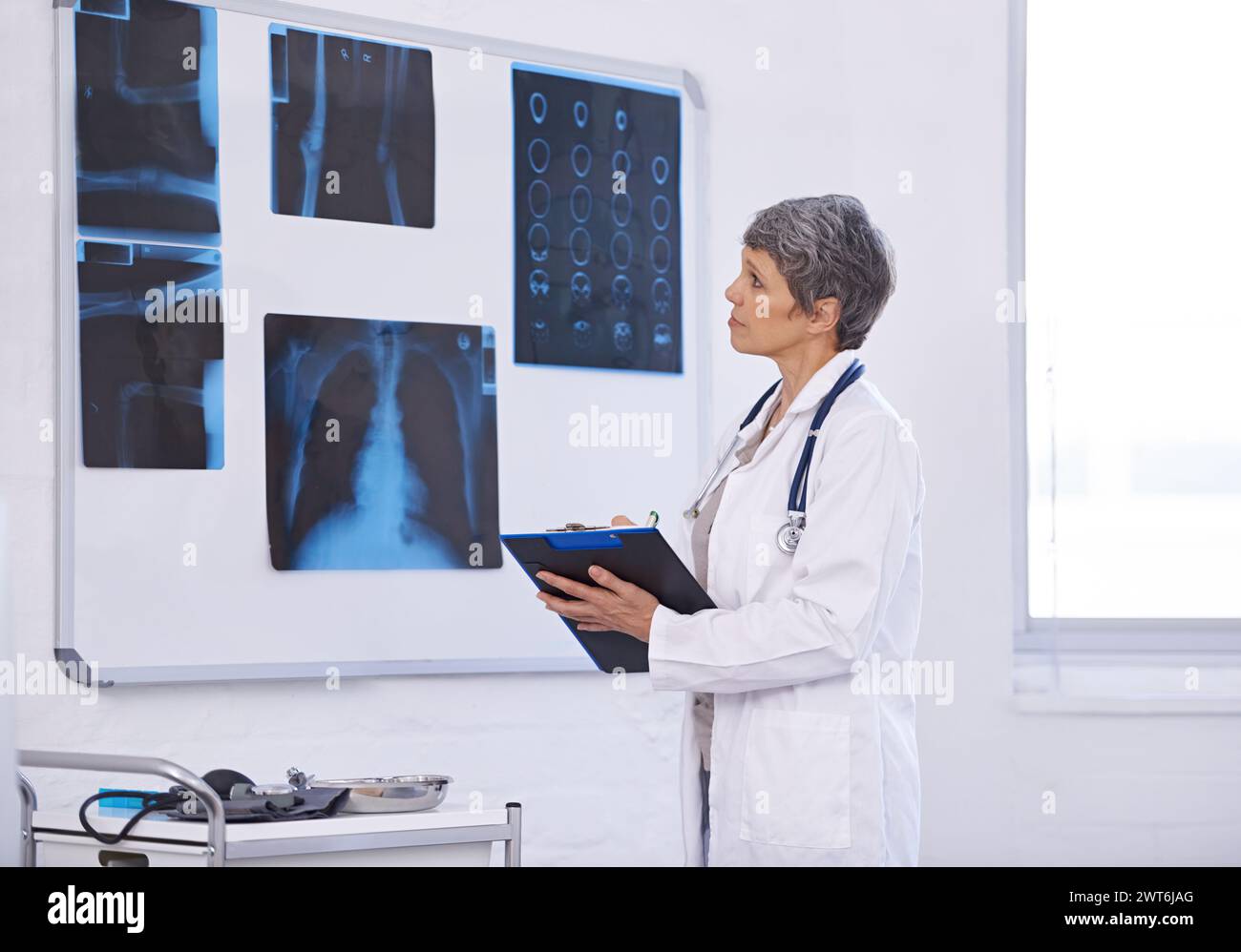 Senior doctor, woman and study xray with clipboard for checklist ...
