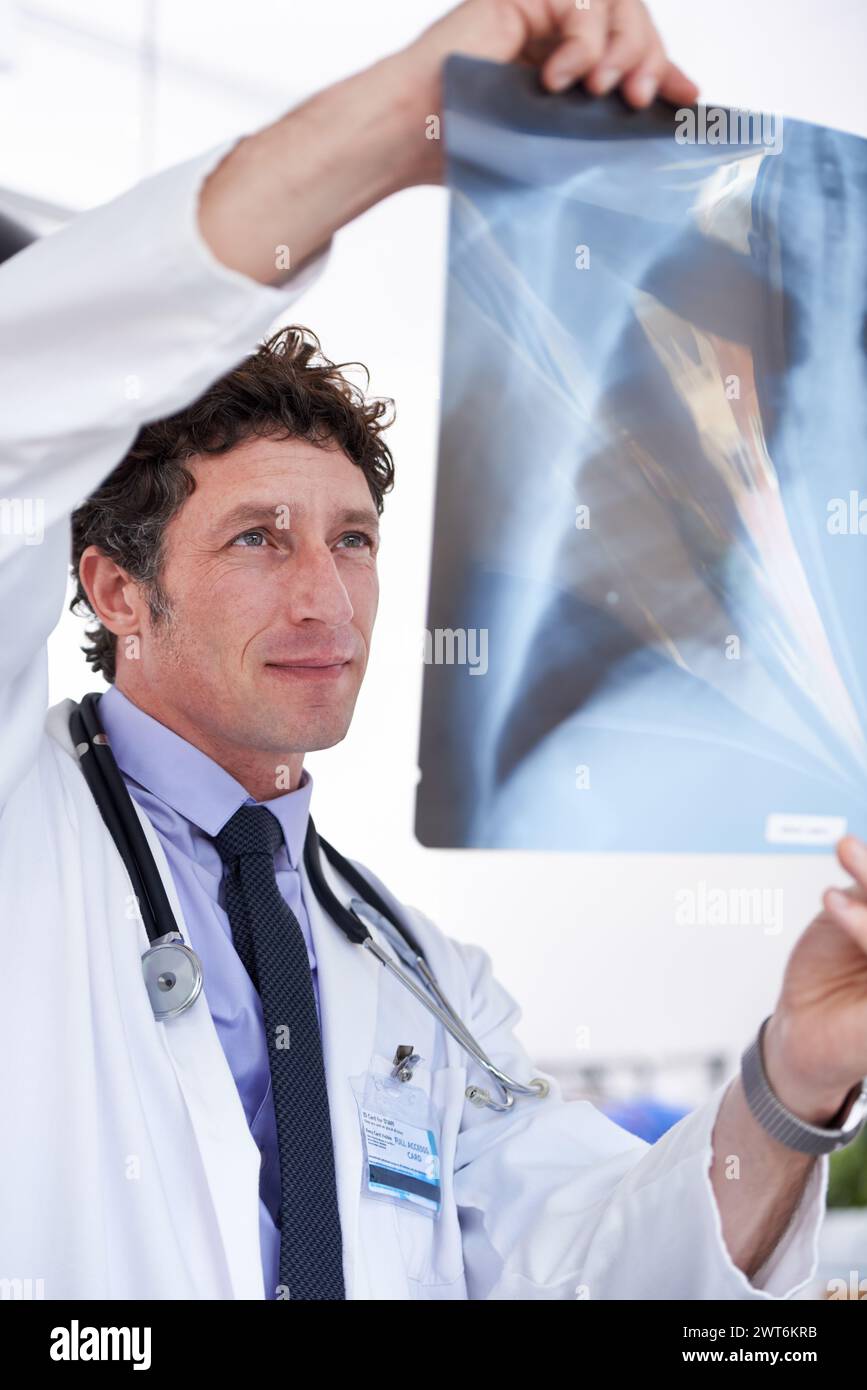 Doctor, man and xray in hospital for reading results with thinking for ...