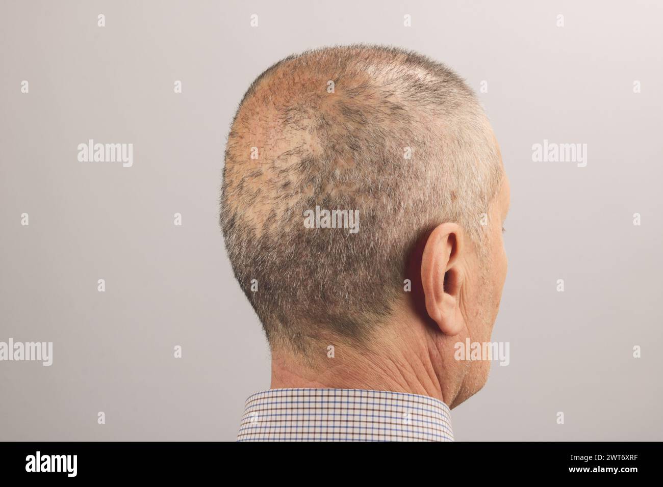 White patch at the back of their head hi-res stock photography and ...