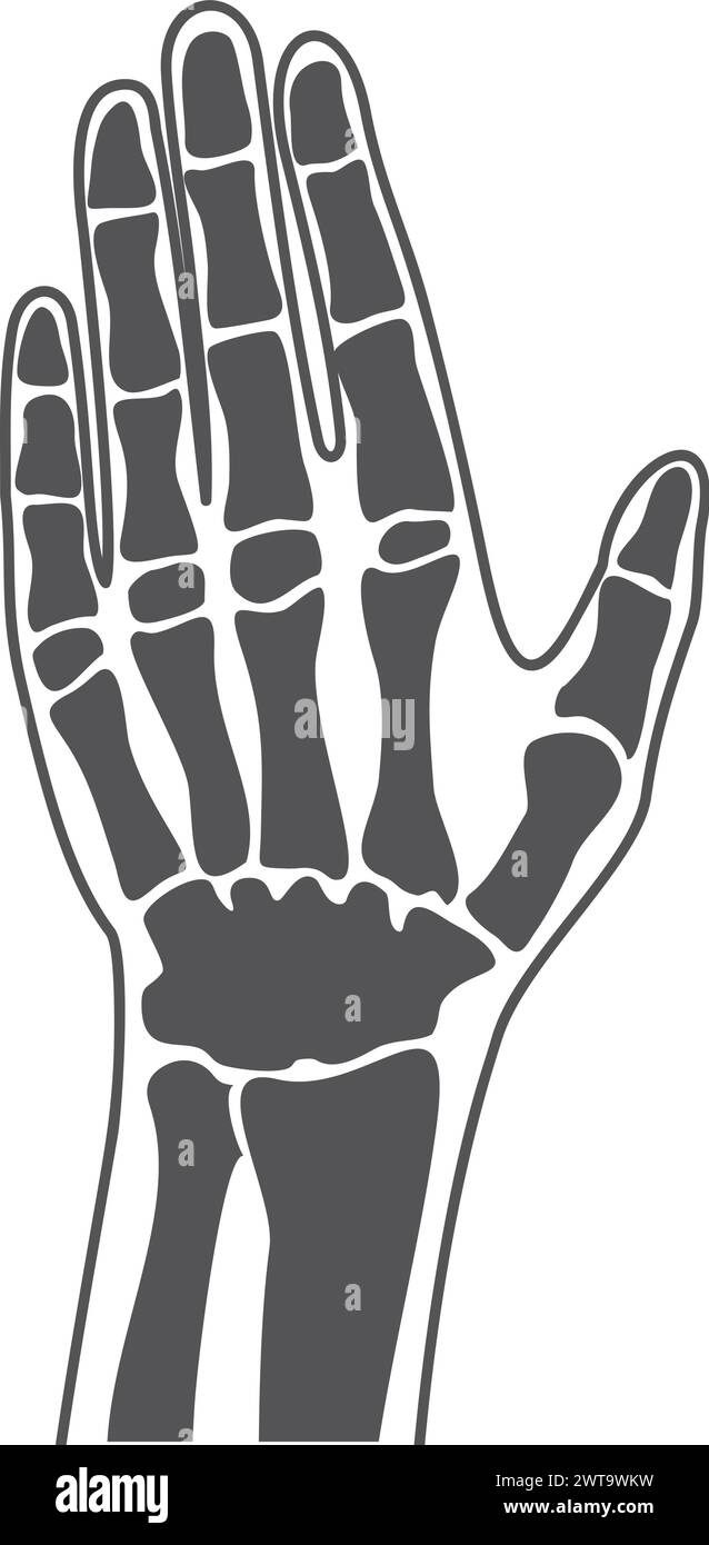 Human palm xray. Hand bones anatomy illustration Stock Vector Image ...