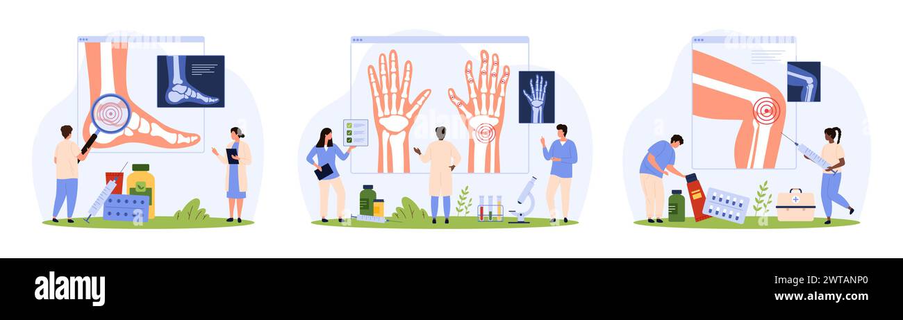 Diagnosis and treatment of osteoarthritis, rheumatoid arthritis ...