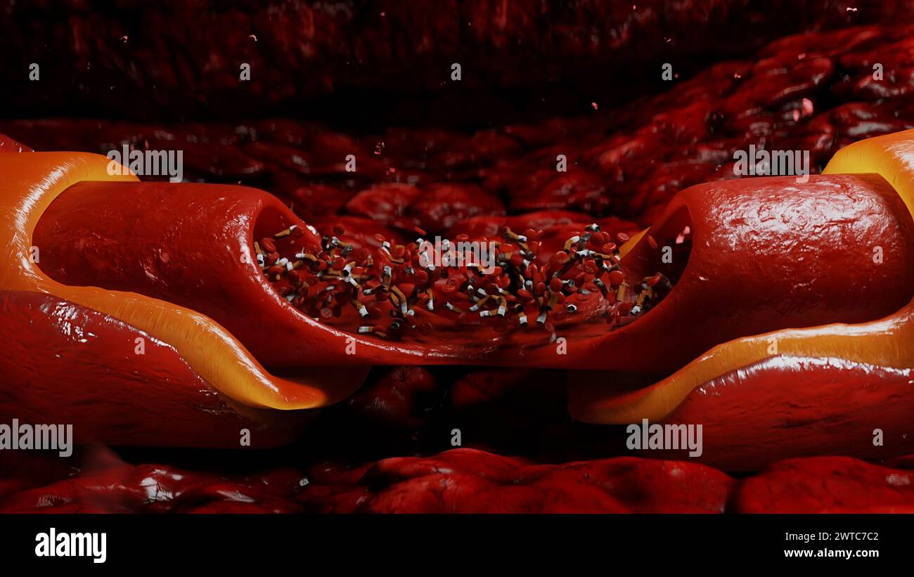 blood stream and cigarette butts. smoking health harm concept. Inside ...