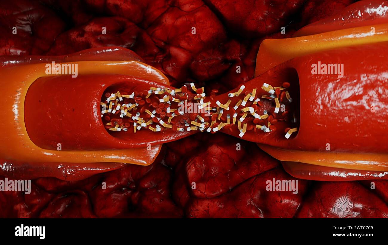 blood stream and cigarette butts. smoking health harm concept. Inside ...