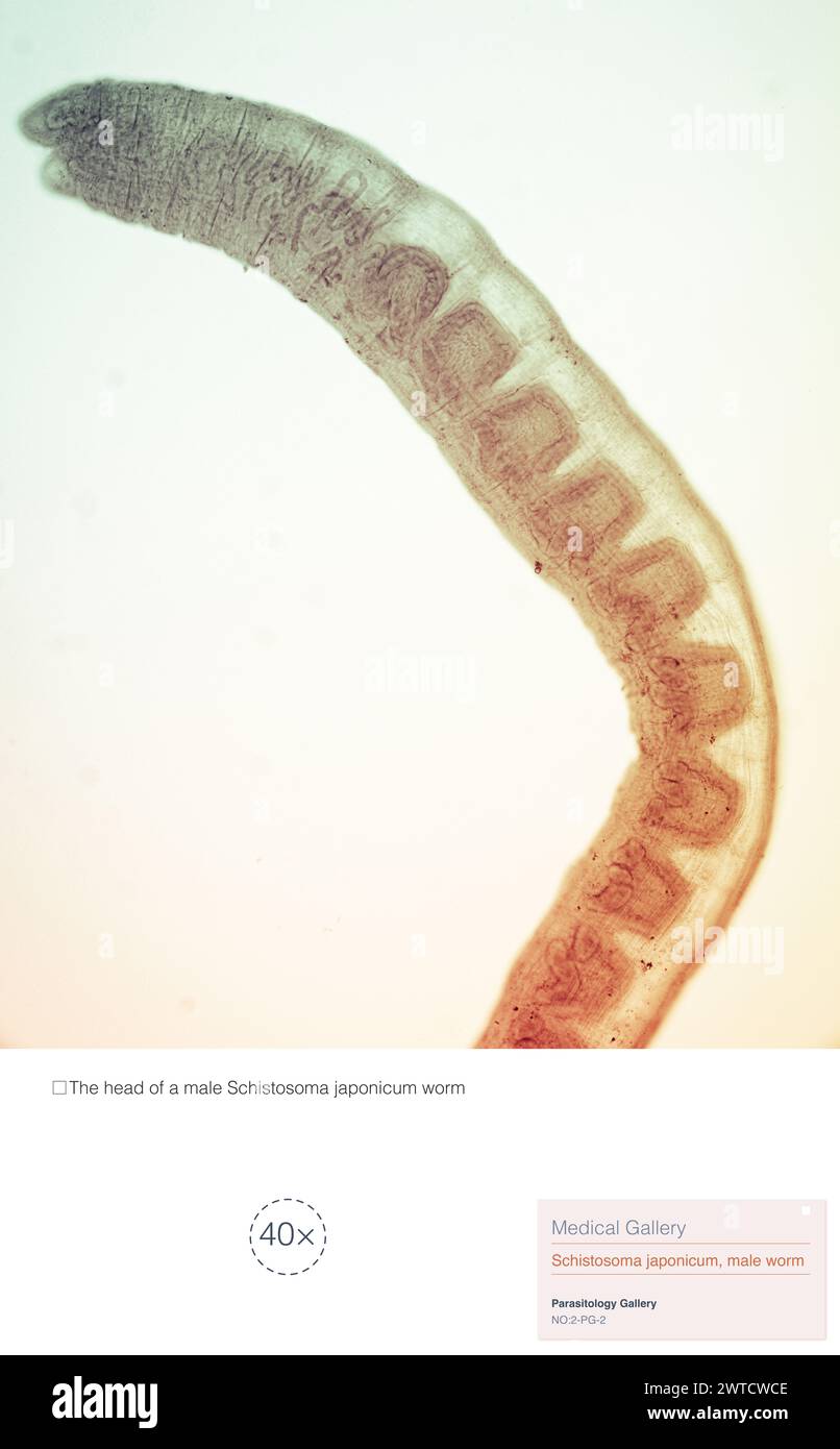 Schistosoma Japonicum Male