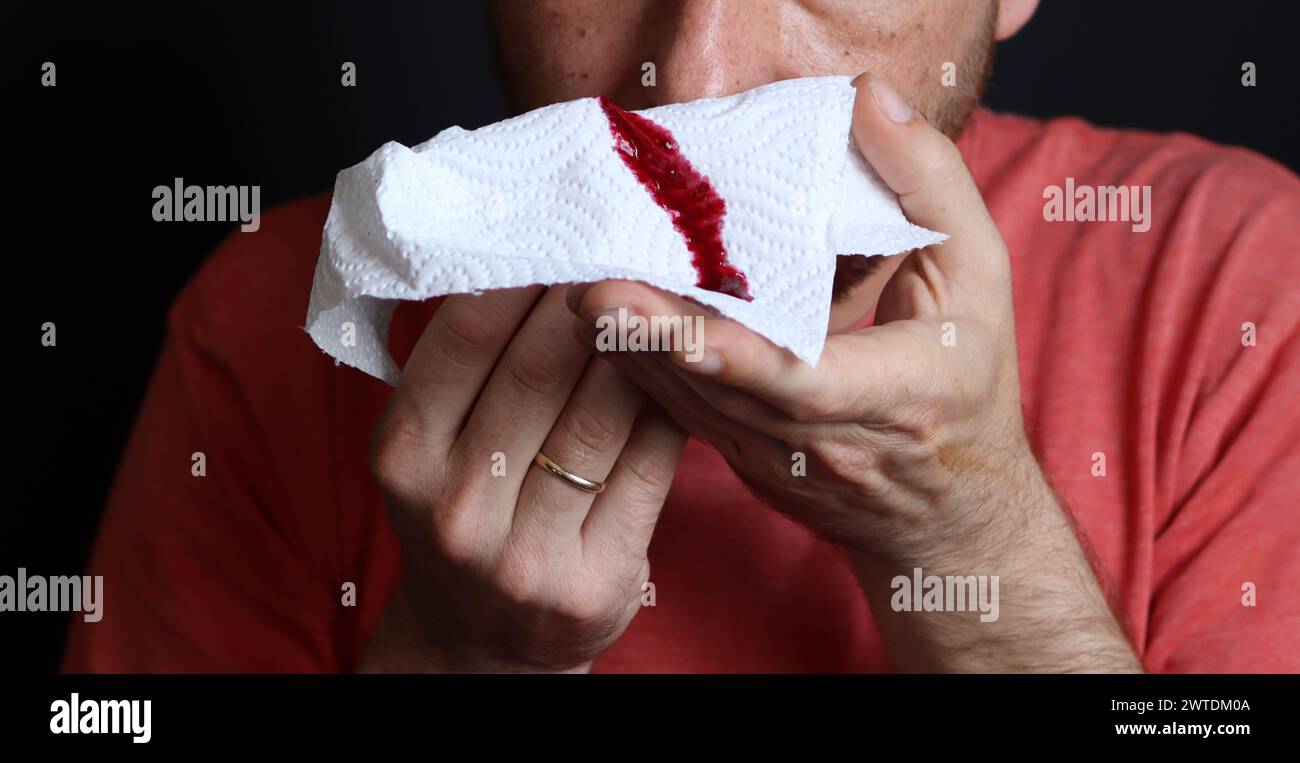 Nose bleed first aid hi-res stock photography and images - Alamy