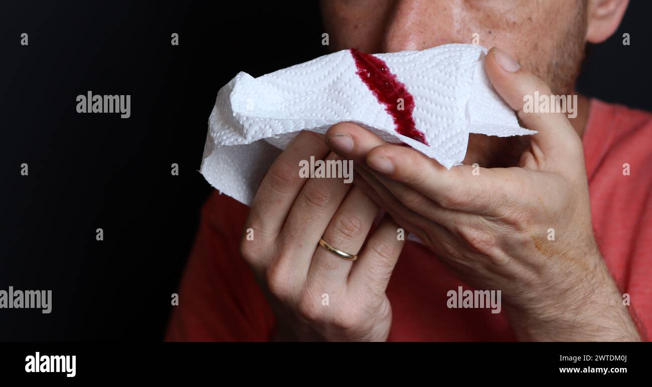 Nose bleed first aid hi-res stock photography and images - Alamy