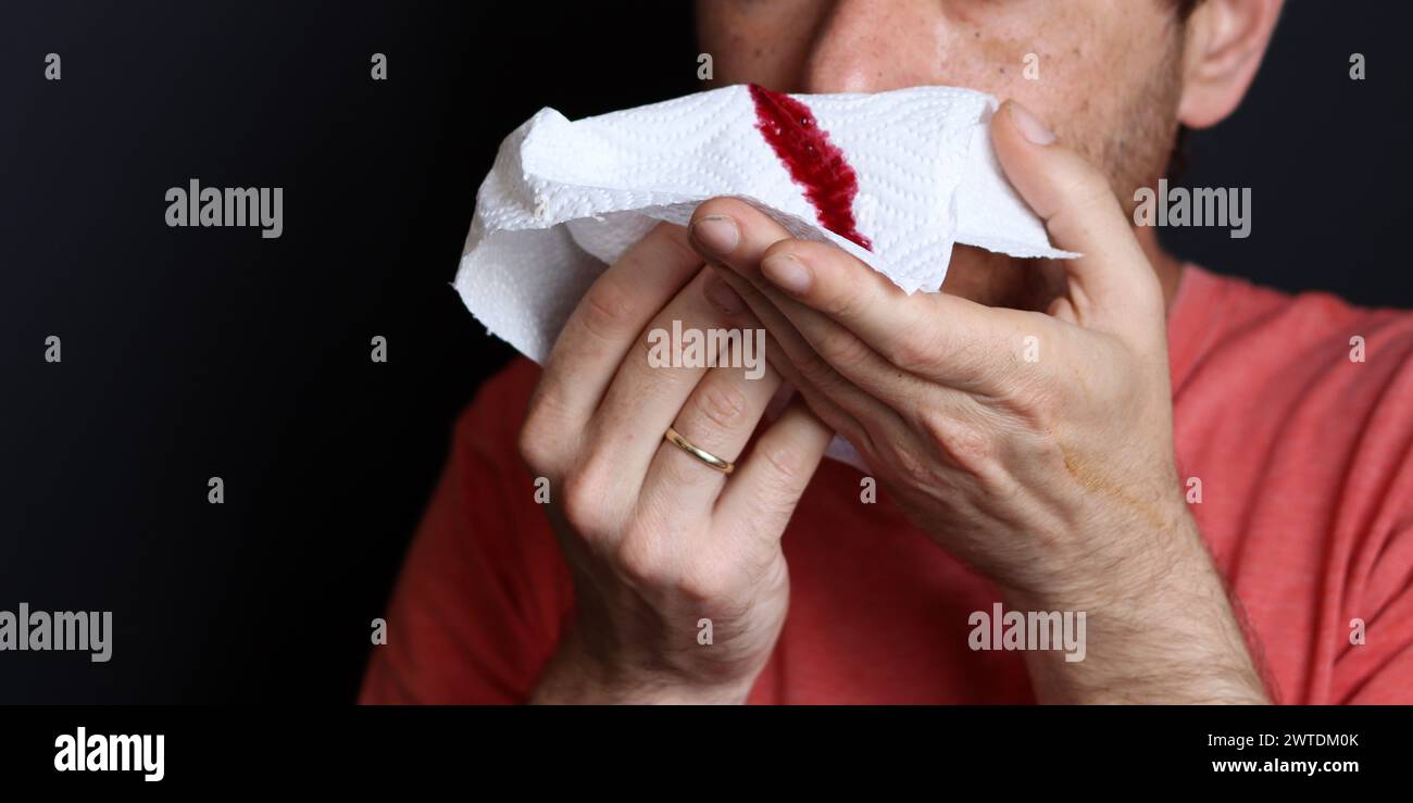 Nose bleed first aid hi-res stock photography and images - Alamy