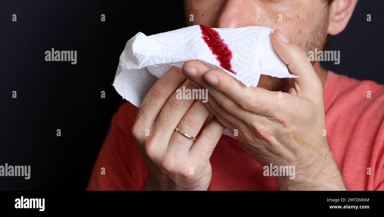 Nose bleed first aid hi-res stock photography and images - Alamy