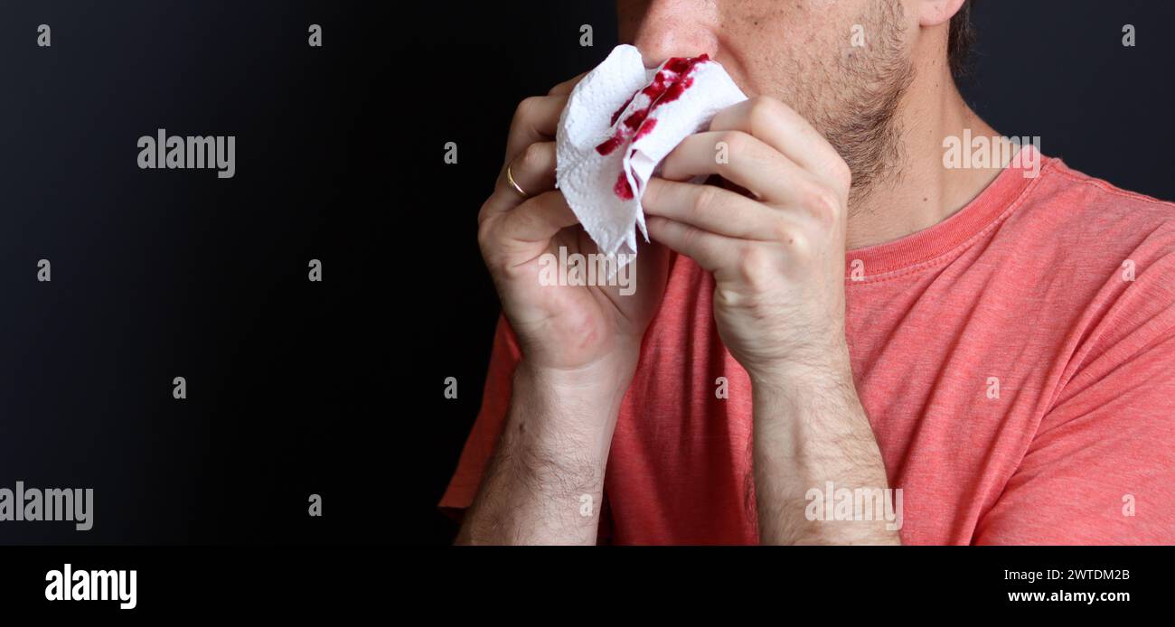 Nose bleed first aid hi-res stock photography and images - Alamy