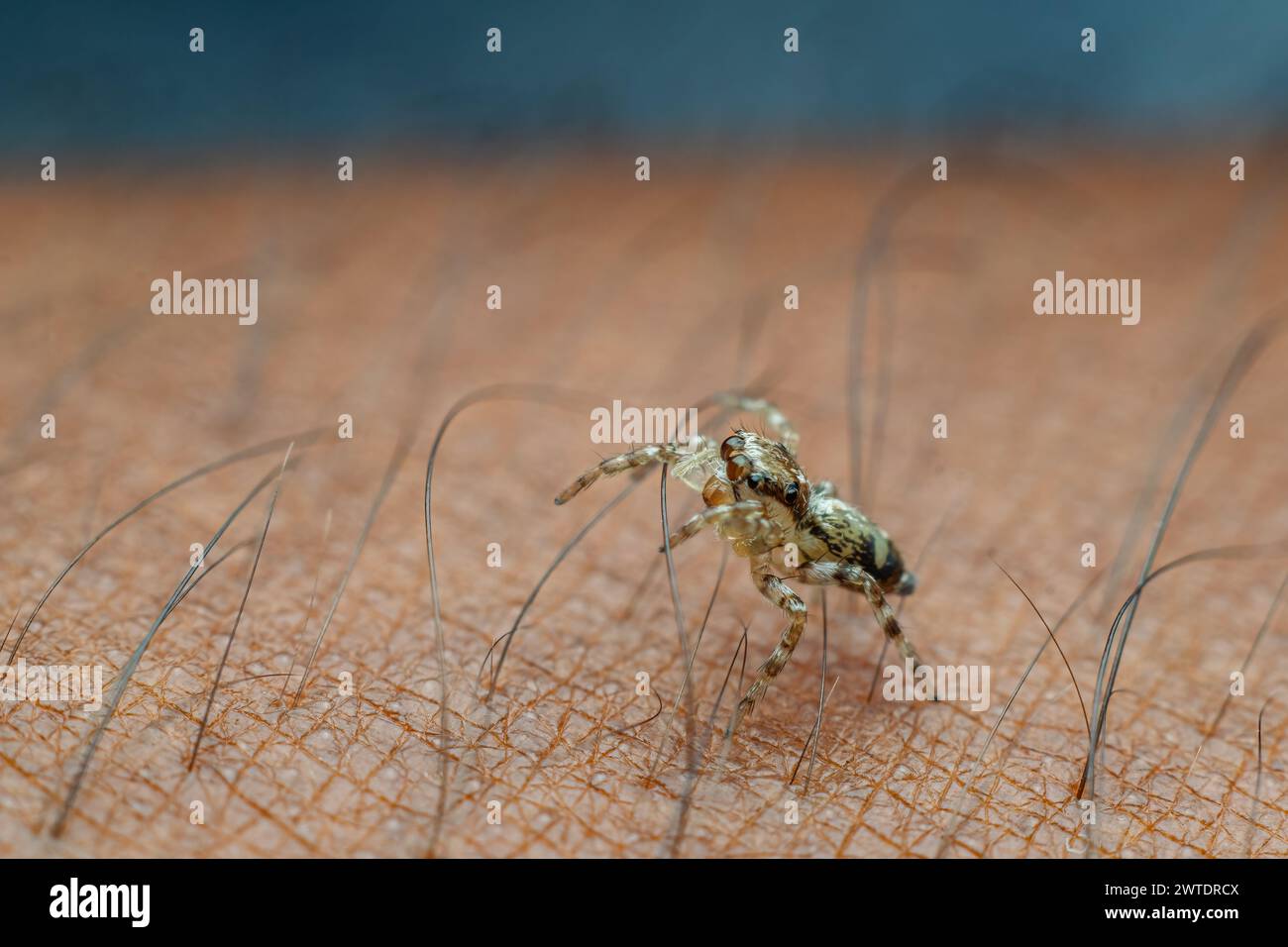 Jumping spider on the human skin. Standing on the human body hair Stock ...