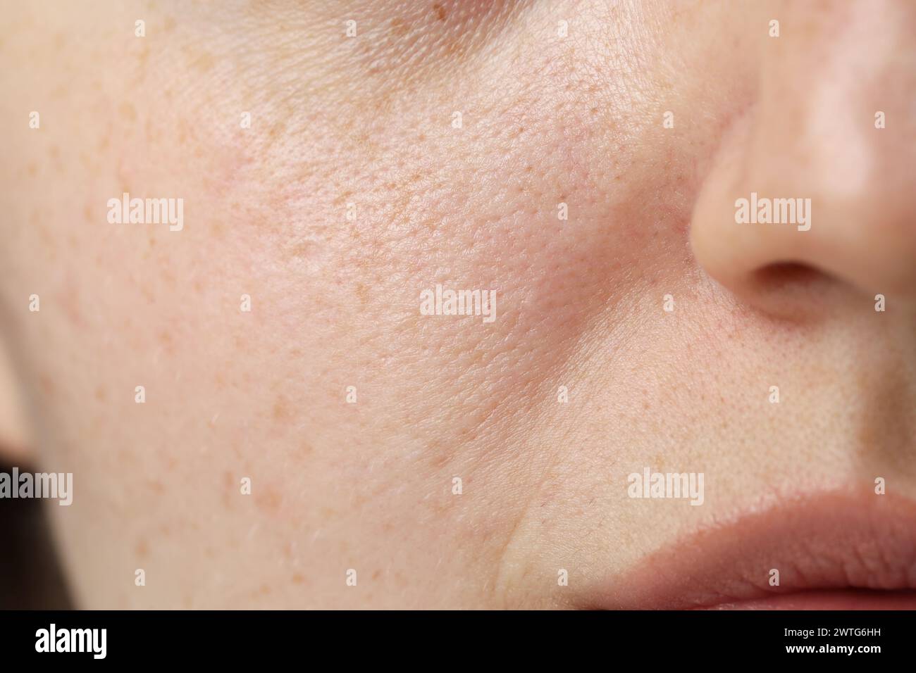 Macro view of woman with dry skin Stock Photo - Alamy