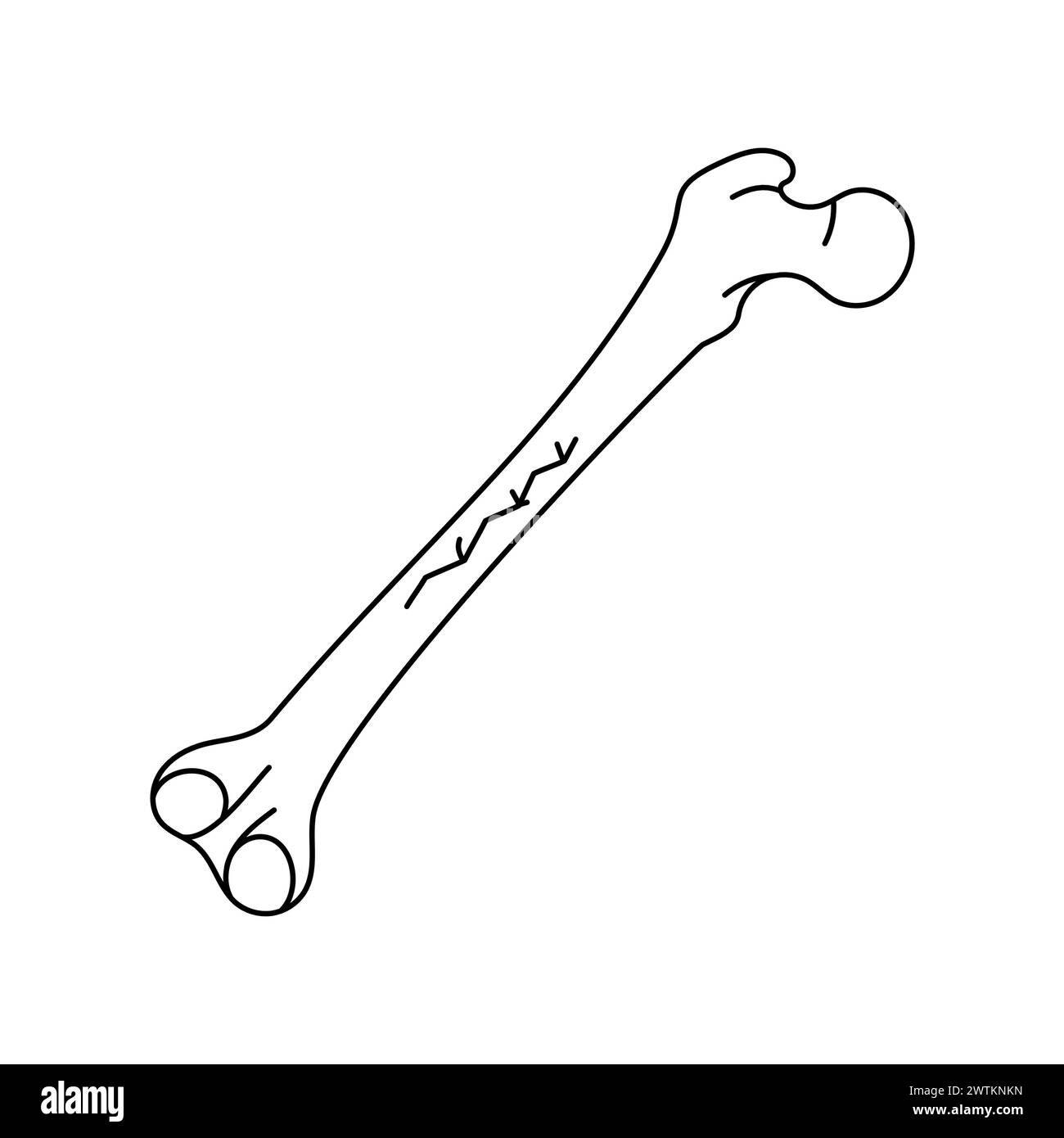 Linear bone fracture line icon. Vector isolated element. Editable ...