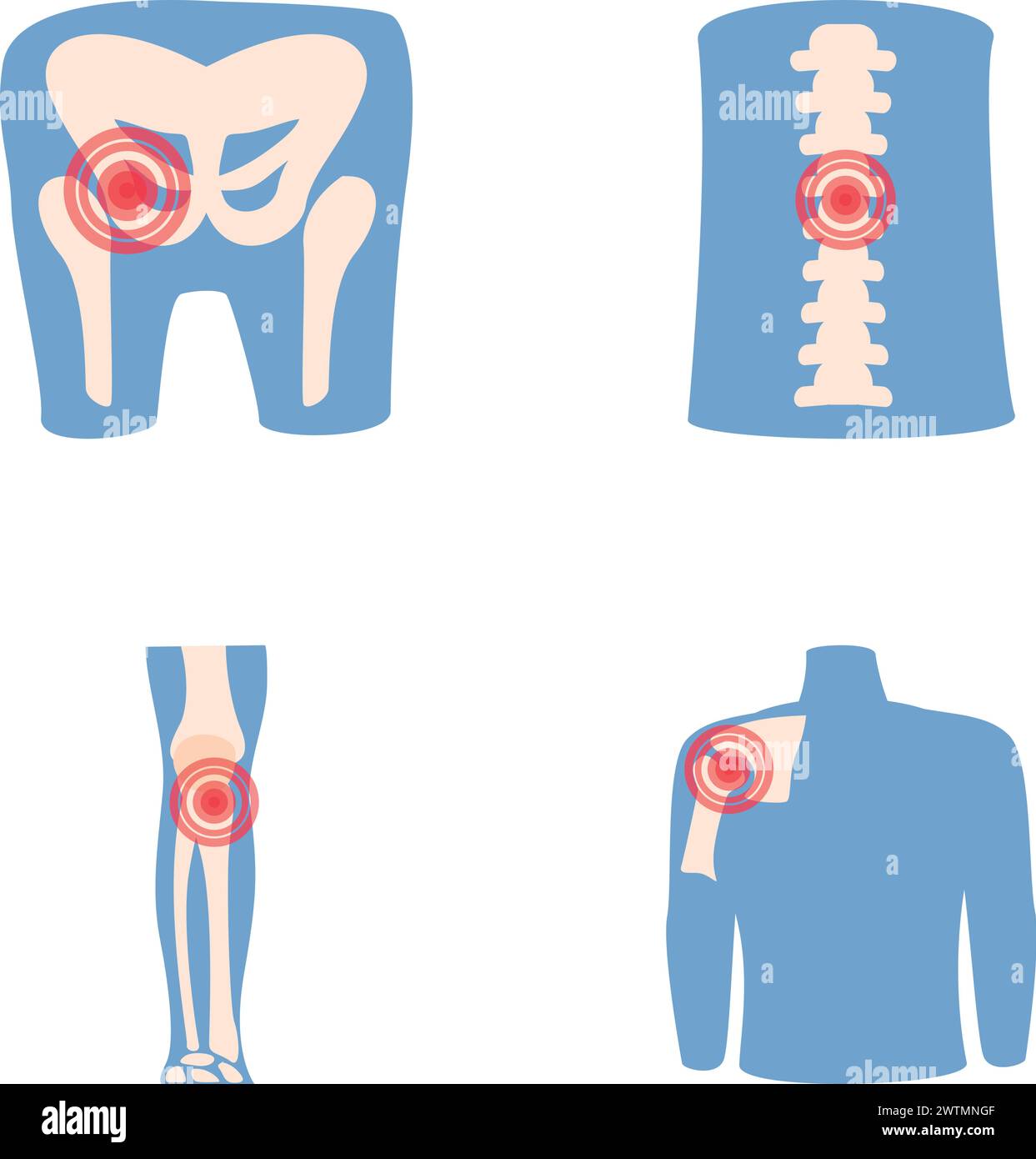 Rheumatism icons set cartoon vector. Human joint with pain ring ...