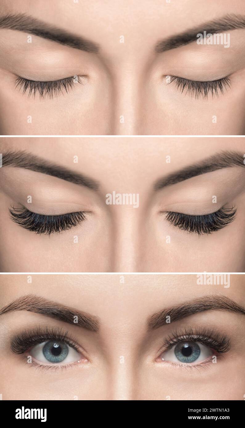 Eyelash removal procedure before and after close up. Beautiful Woman ...