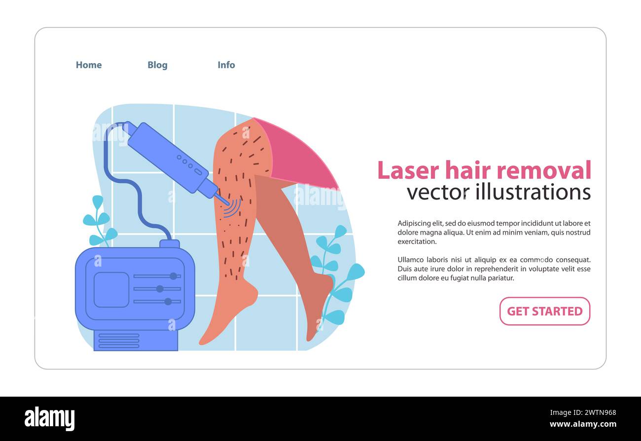 Advanced laser hair removal. A precise and pain-free method for ...