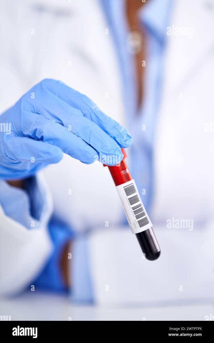 Blood test red tube report hi-res stock photography and images - Alamy
