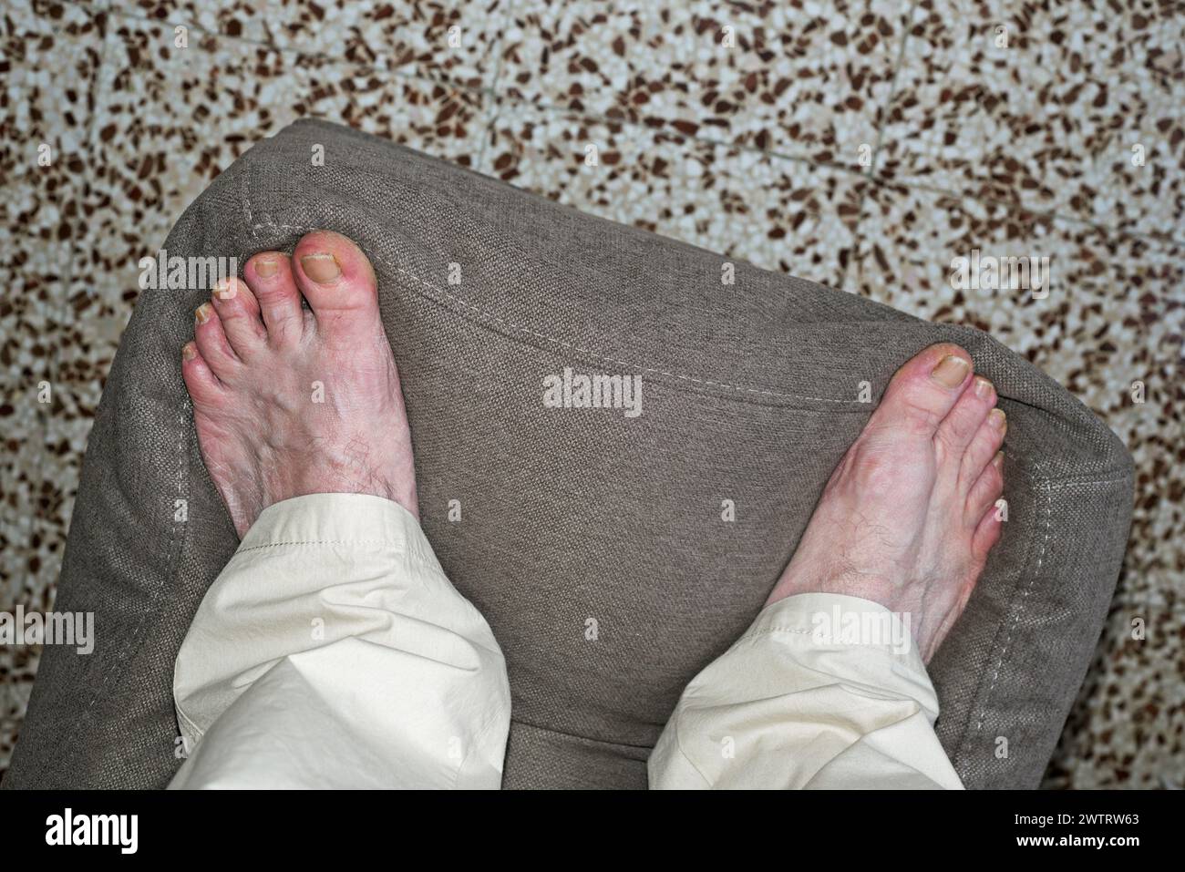 Feet barefoot high hi-res stock photography and images - Alamy