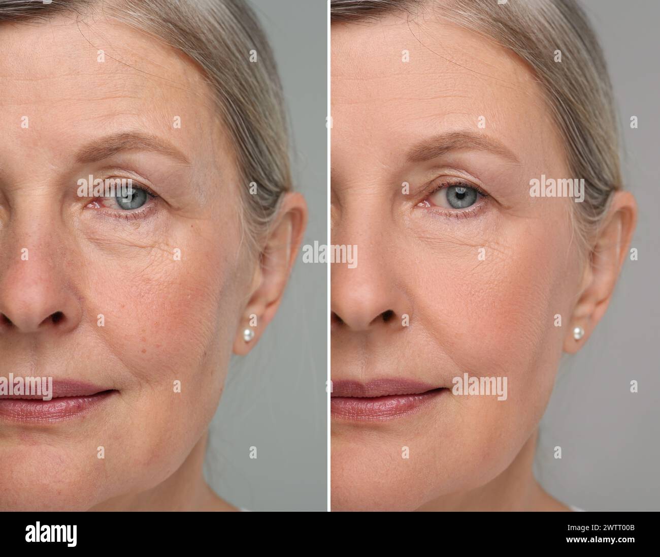 Aging skin changes. Collage with photos of mature woman before and ...