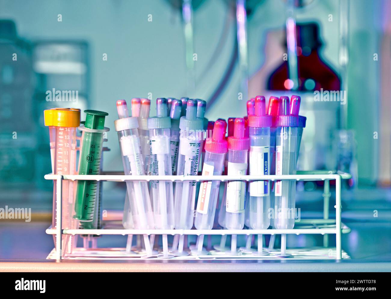 Laboratory test tubes in a rack with a scientific research background ...