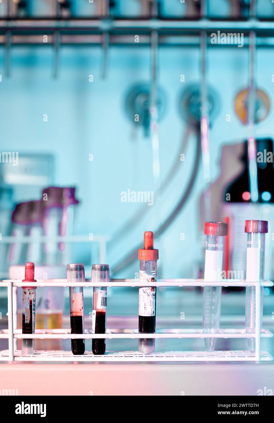 Lab vials with samples standing ready for analysis Stock Photo - Alamy