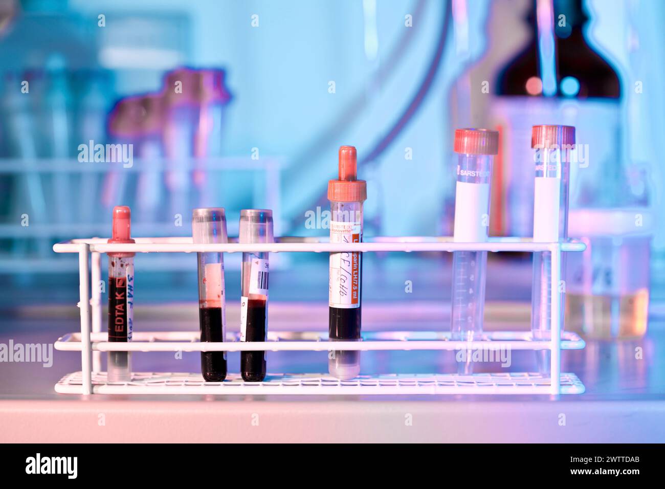 Test tubes filled with samples sitting on a lab bench Stock Photo - Alamy