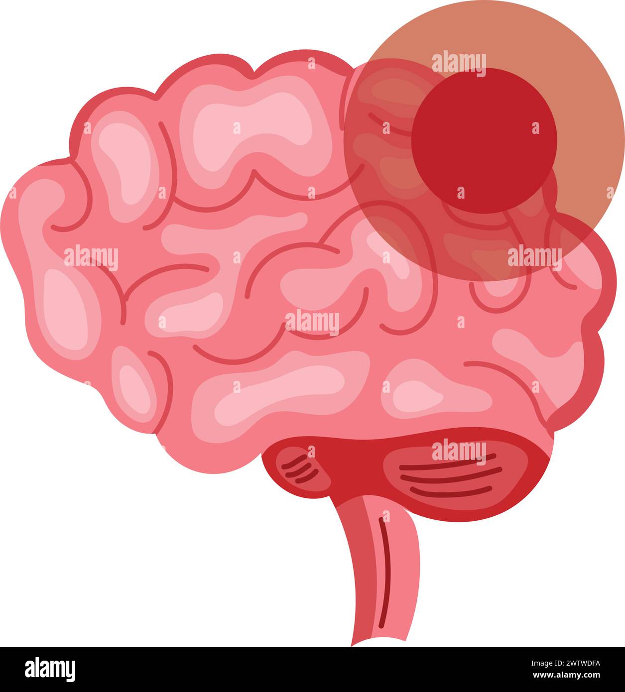 Electrical stimulation brain hi-res stock photography and images - Alamy