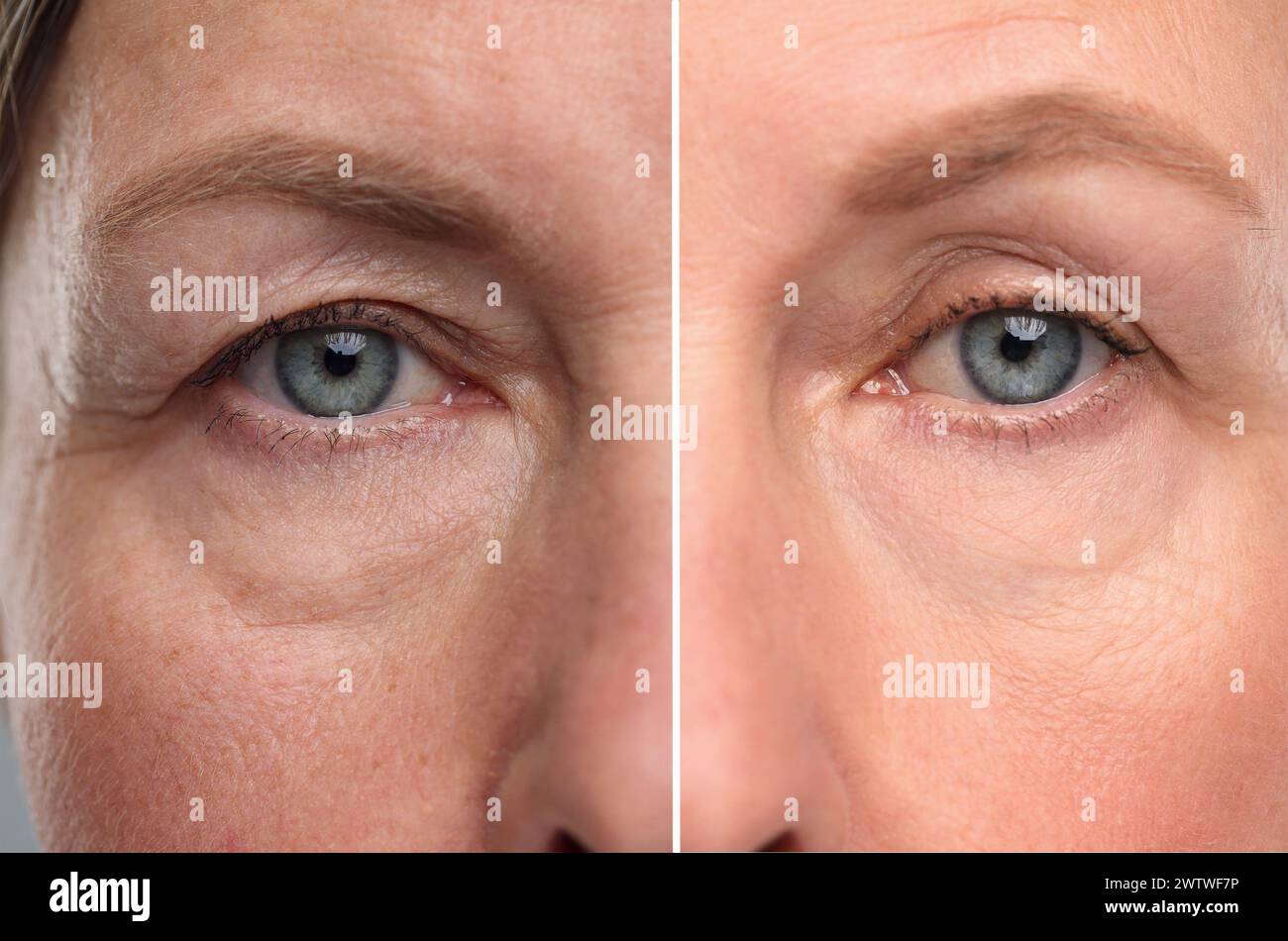 Aging skin changes. Collage with photos of mature woman before and ...