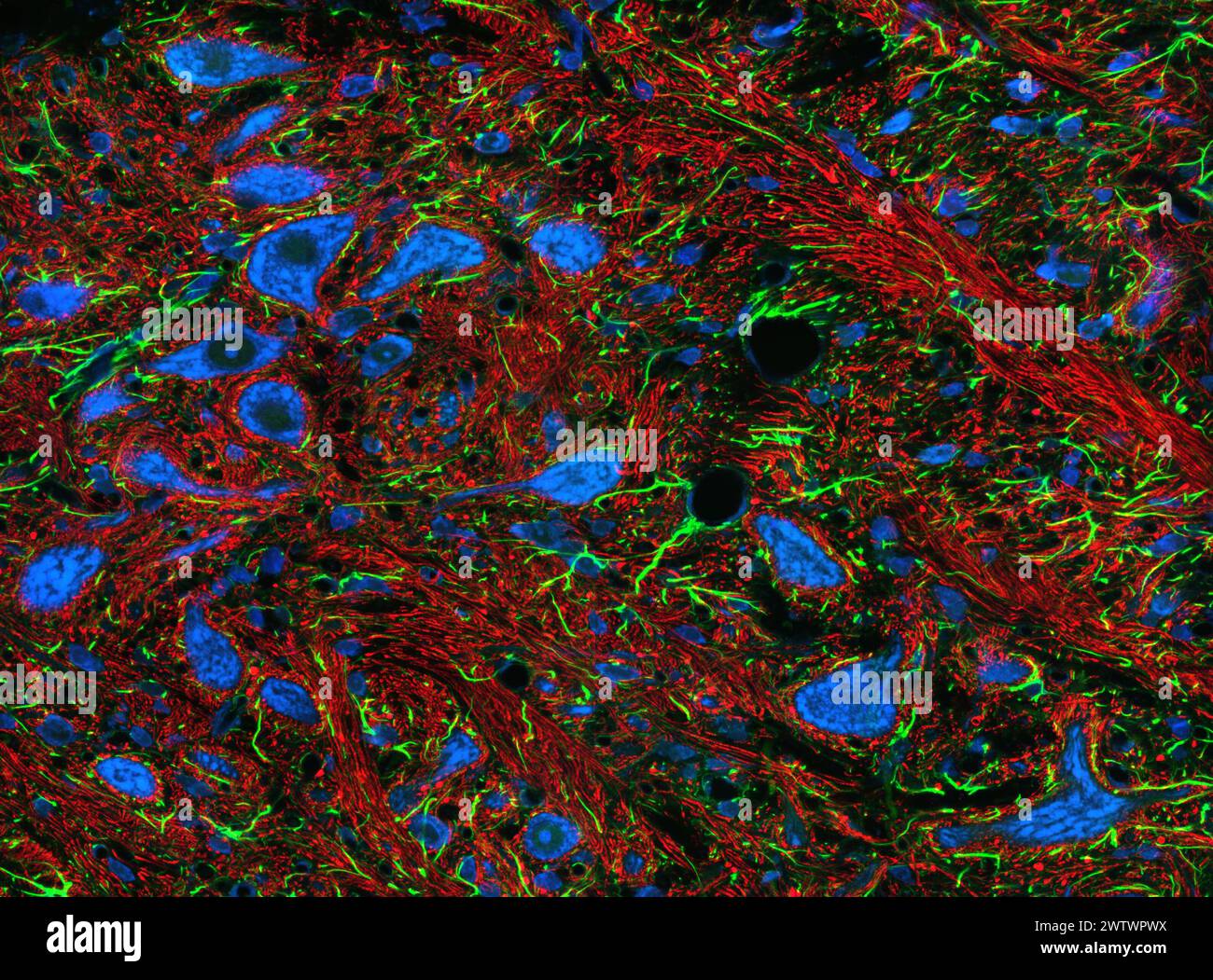 Confocal light micrograph of a section through tissue from the cortex ...