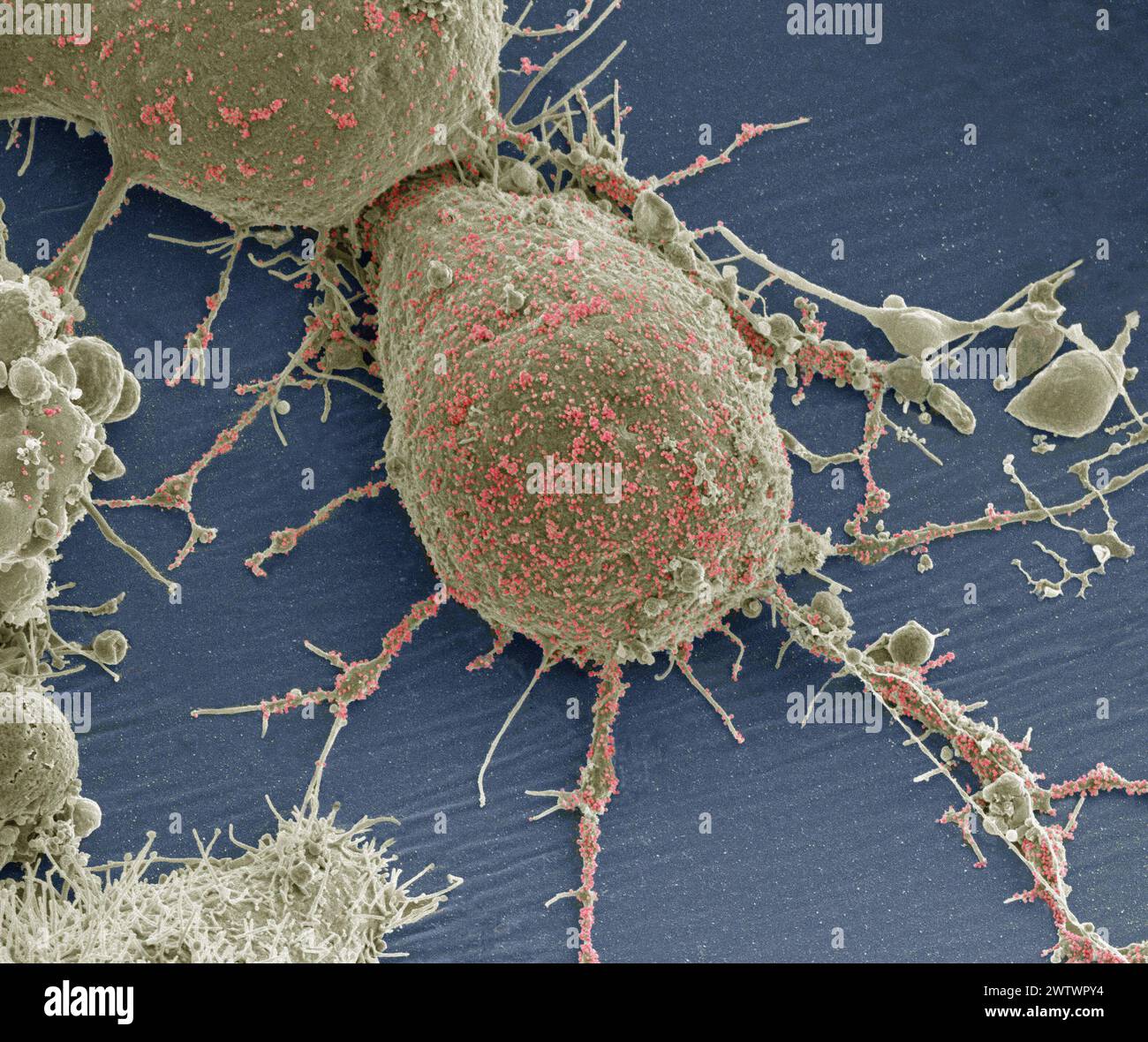 Coloured scanning electron micrograph (SEM) of HIV particles (red ...