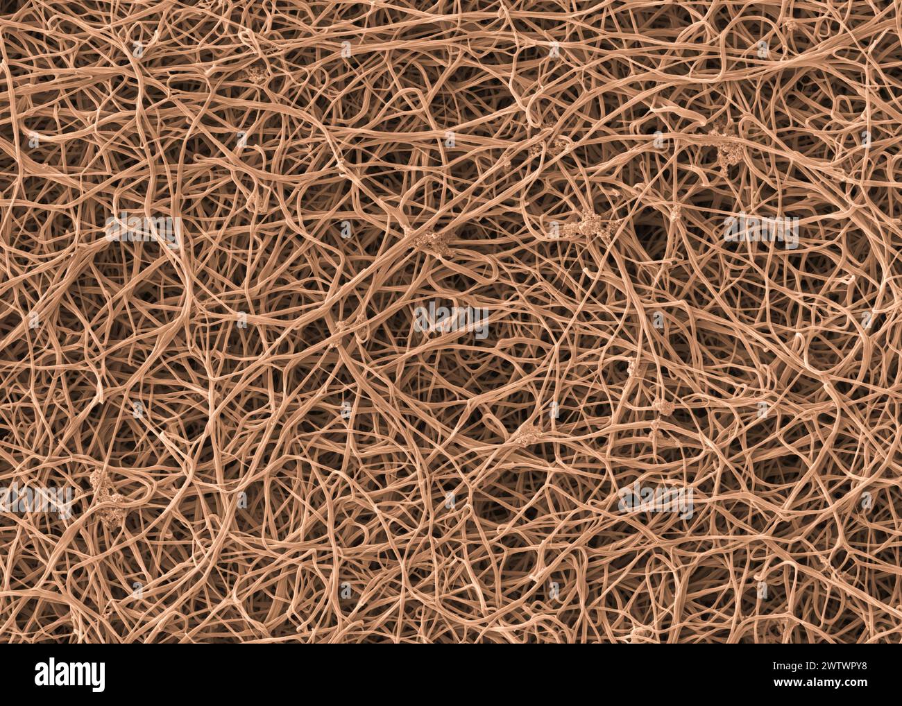 Coloured scanning electron micrograph (SEM) of the fibrin protein ...