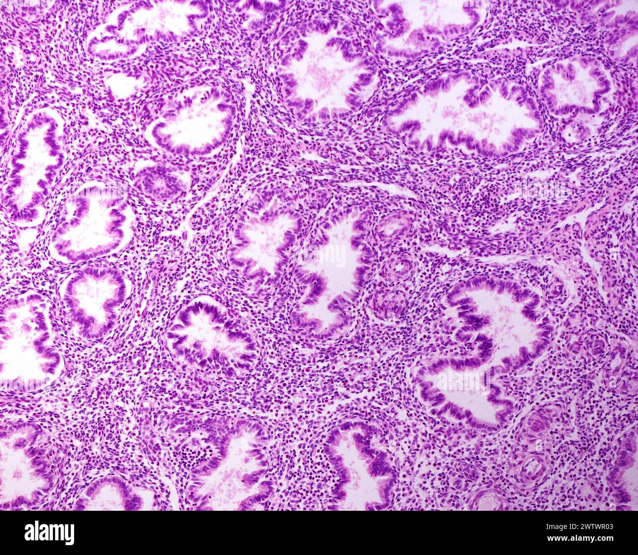 Endometrial glands in secretory phase, light micrograph. During the ...