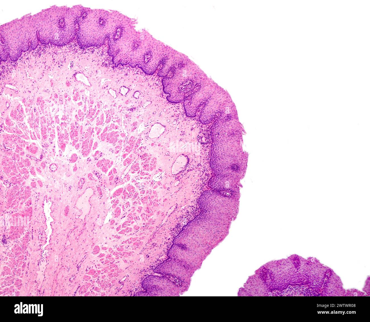 Light micrograph of a human oesophagus showing, from top, mucosa lined ...