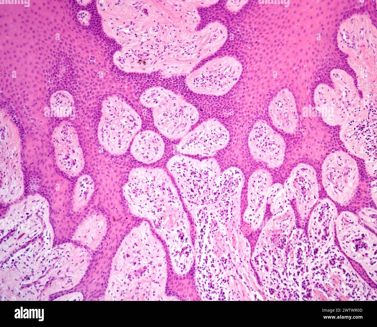 Light micrograph of human gingiva (gums). It is lined by a non ...