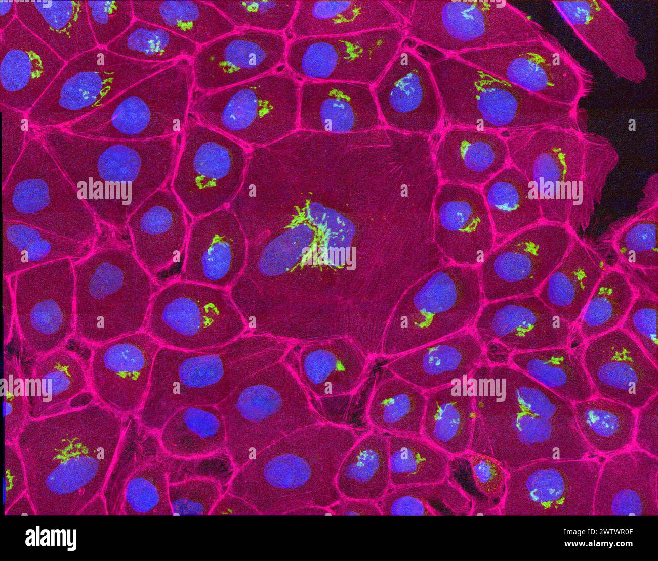Confocal light micrograph of cultured MDCK (Madin-Darby canine kidney ...