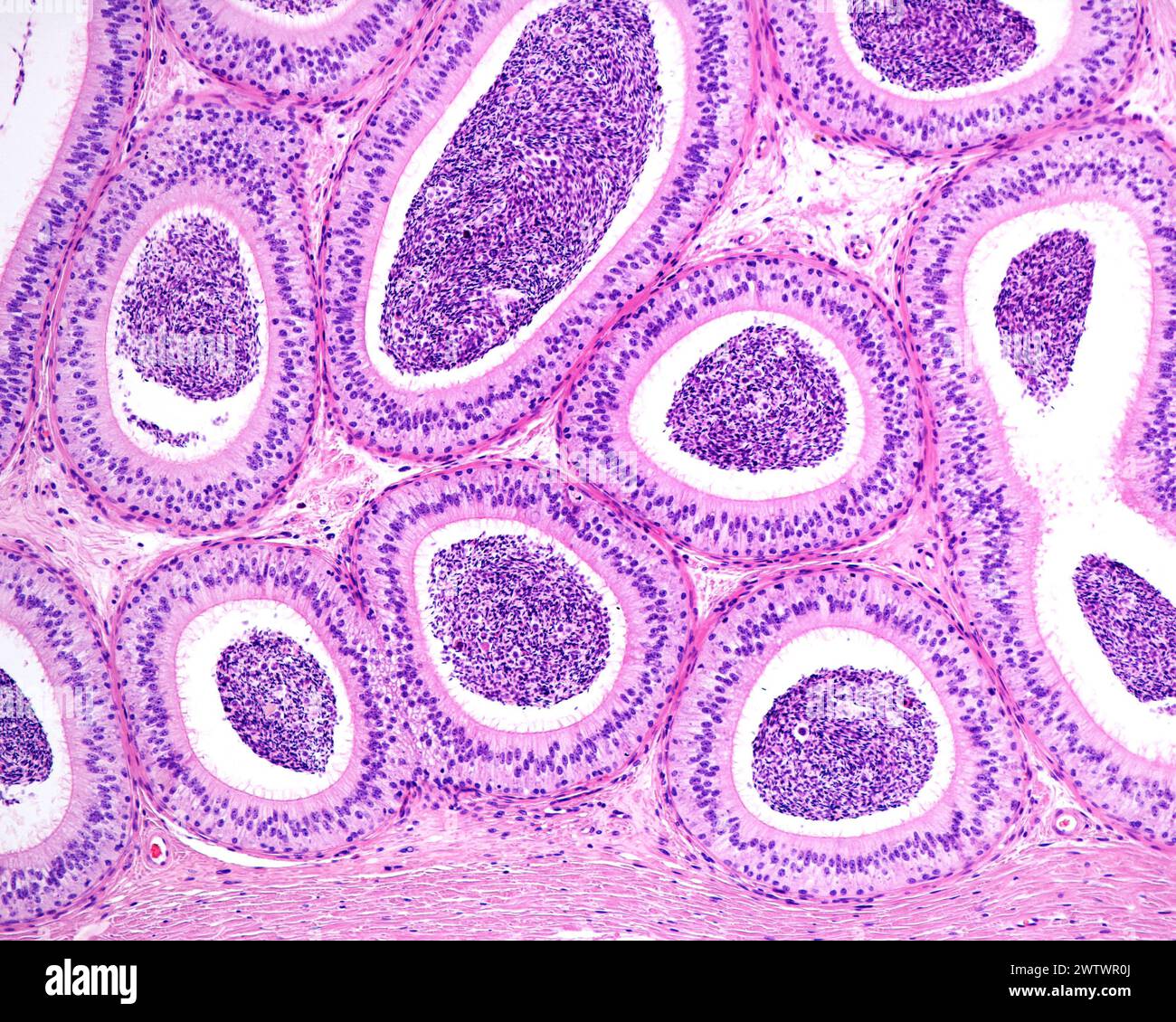 Light micrograph of epididymal ducts lined by pseudostratified ...