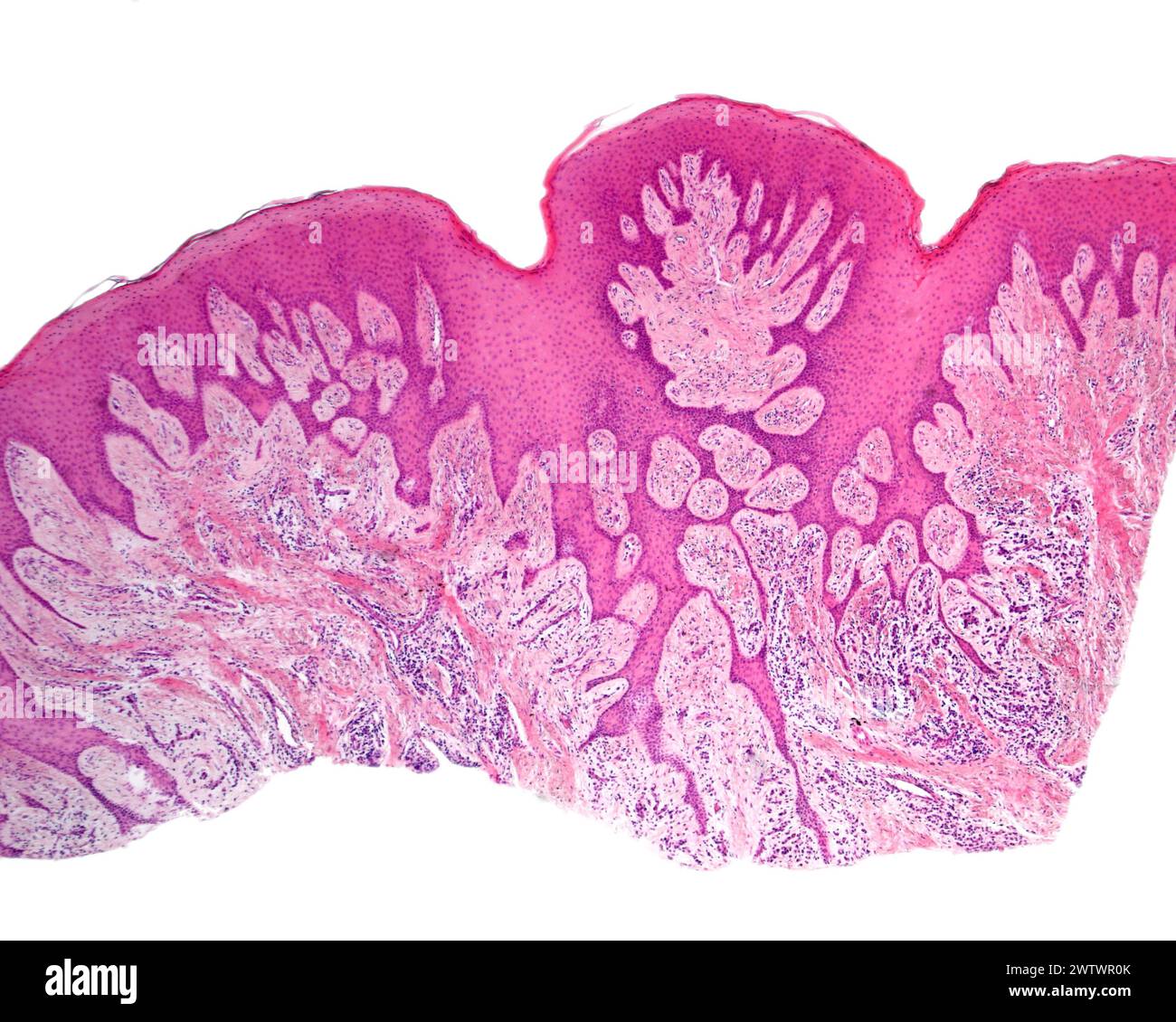Light micrograph of human gingiva (gums) showing the long and complex ...