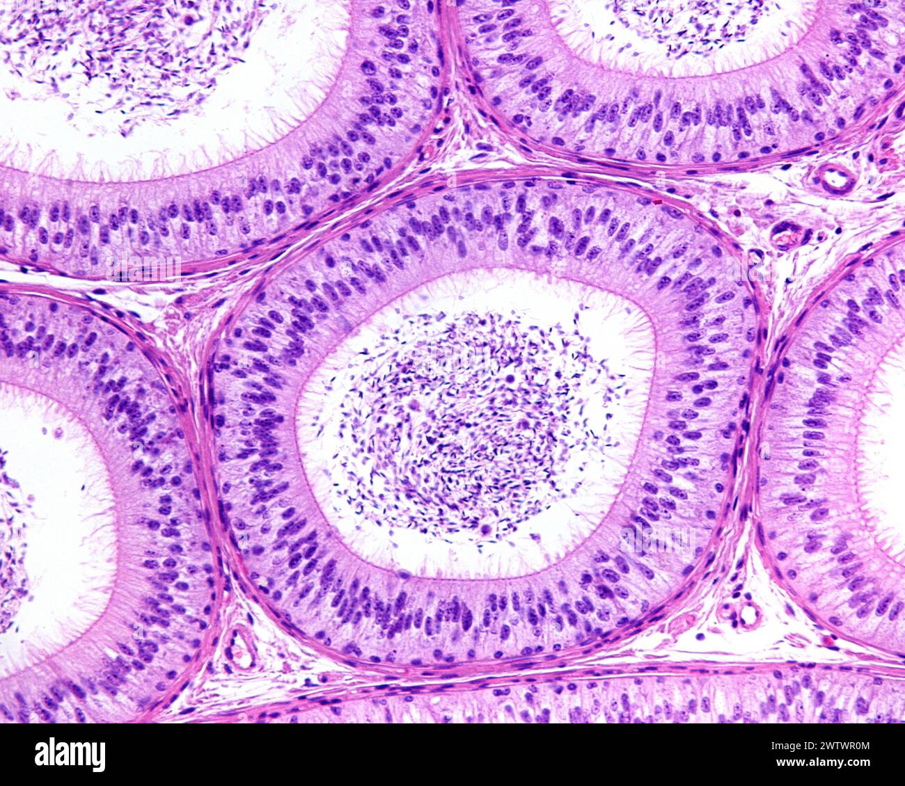 Light micrograph of epididymal ducts lined by pseudostratified columnar ...