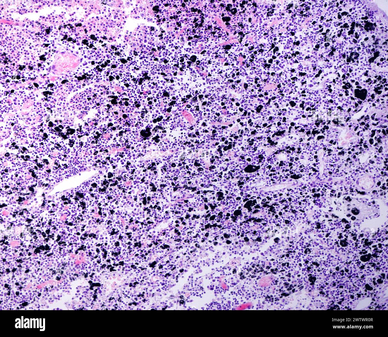 Light micrograph of a human lymph node located near the hilus of an ...