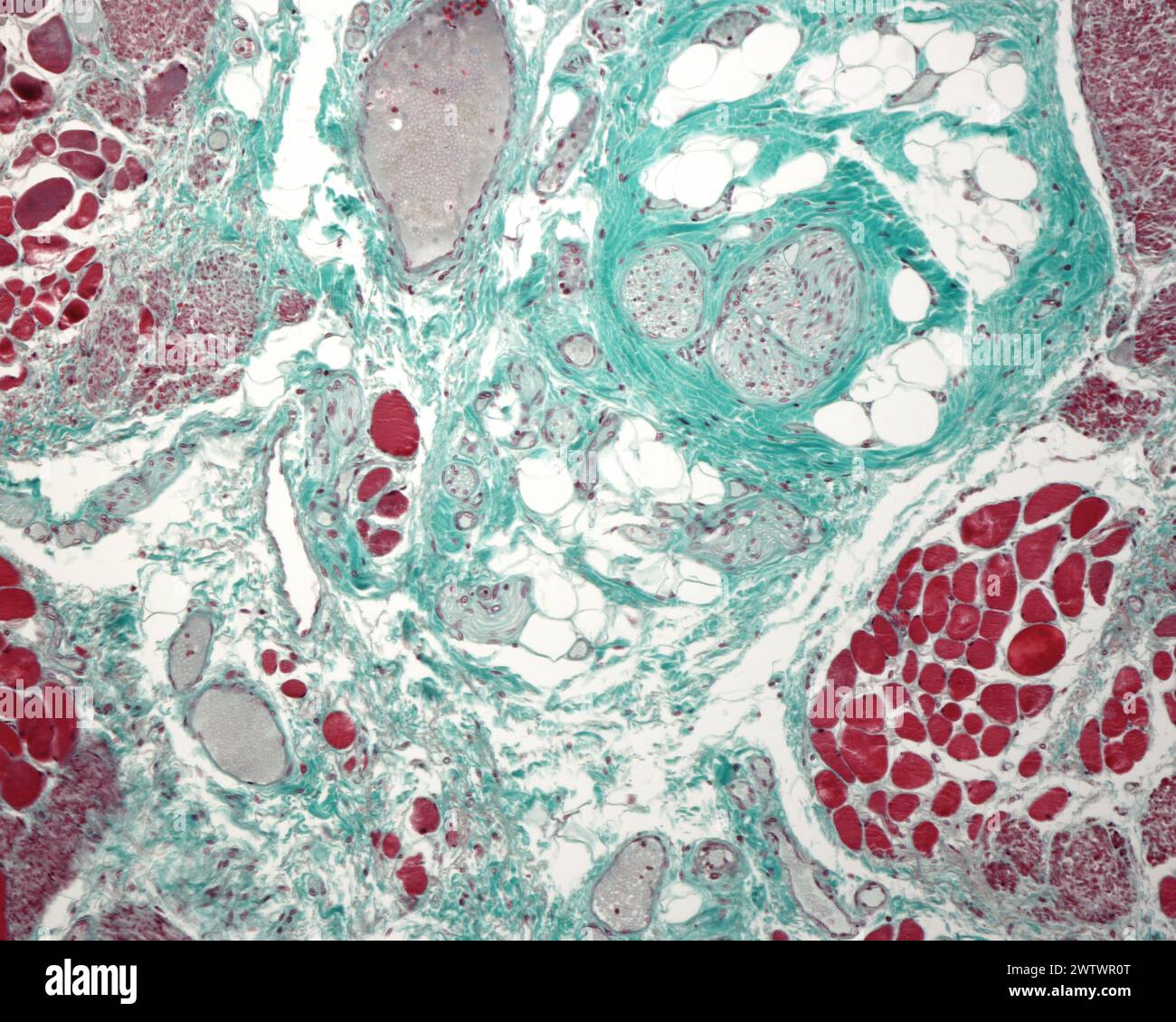 Light micrograph of connective tissue from the submucosa of the ...