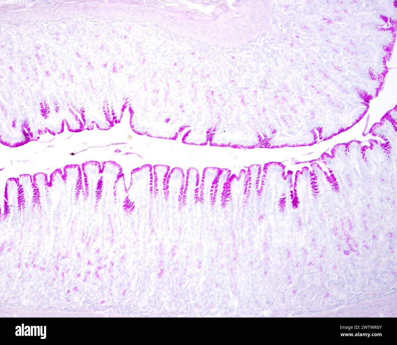 Light micrograph of the gastric mucosa stained with the Periodic acid ...