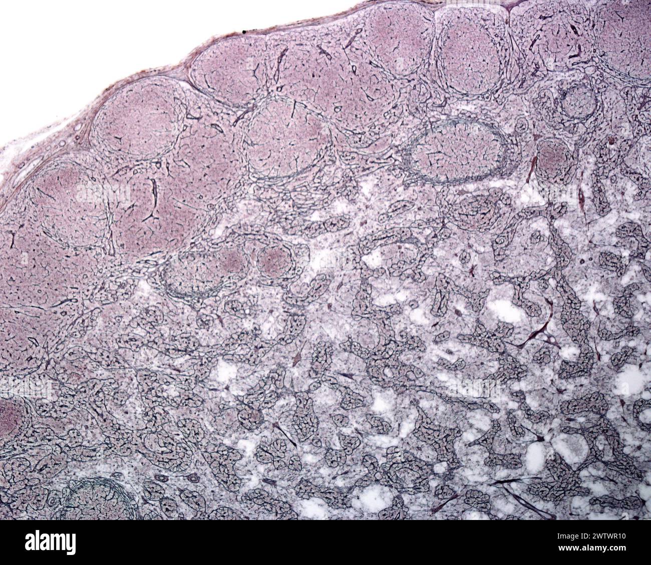 Light micrograph of a lymph node stained with a silver technique for ...