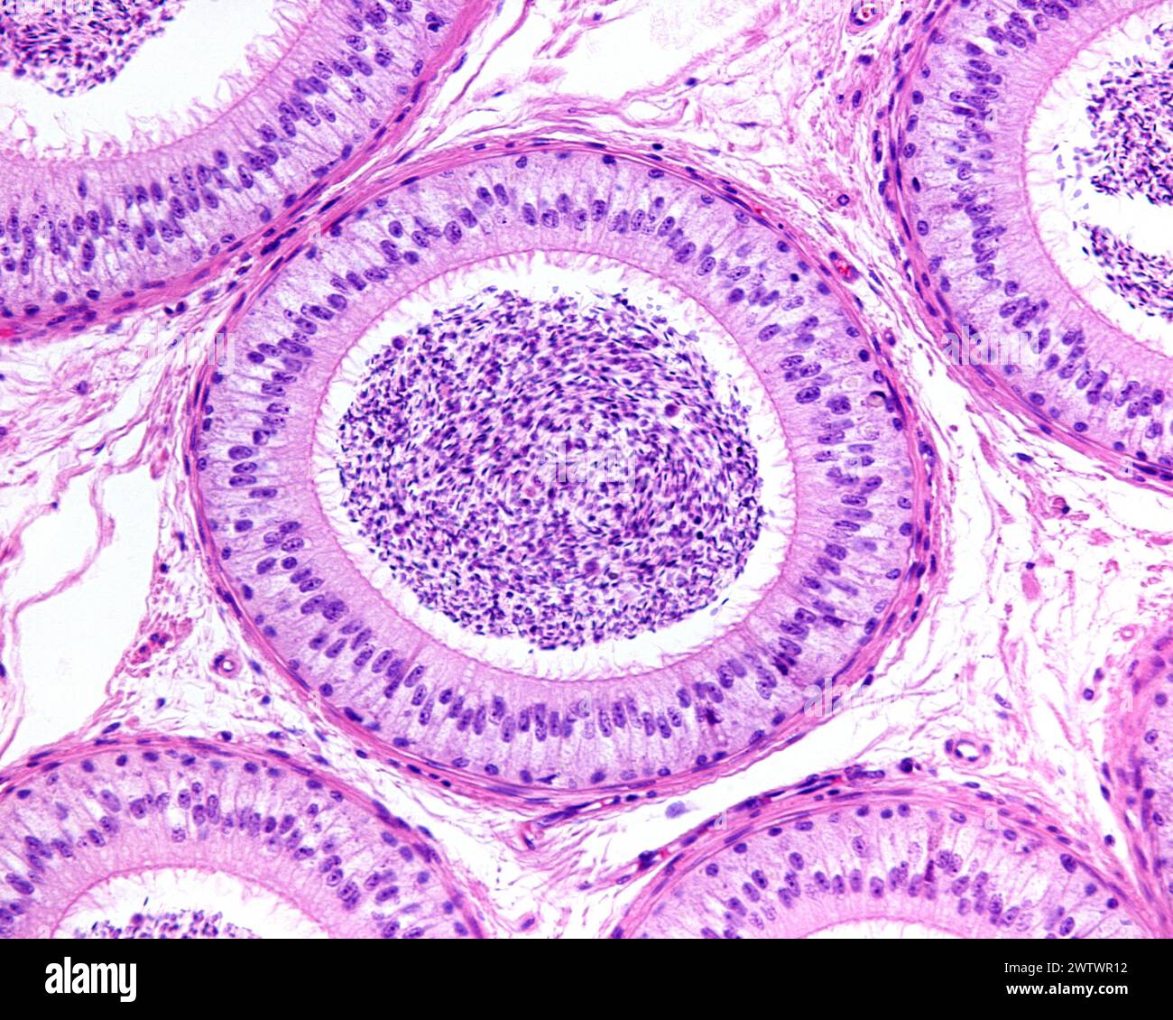 Light micrograph of epididymal ducts lined by pseudostratified ...