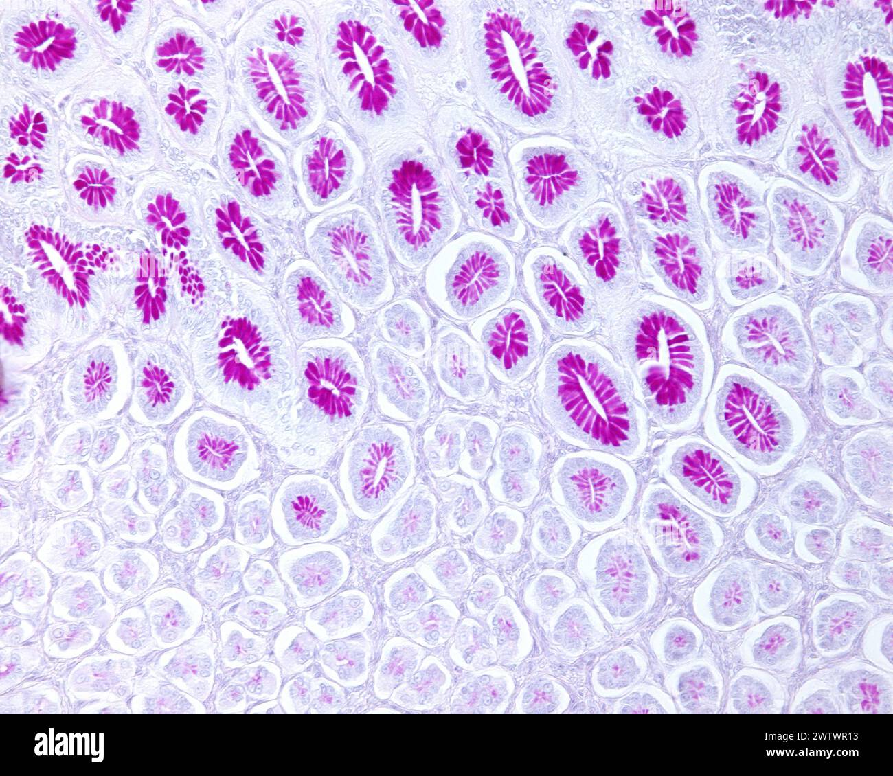 Light micrograph of the gastric mucosa stained with the Periodic acid ...